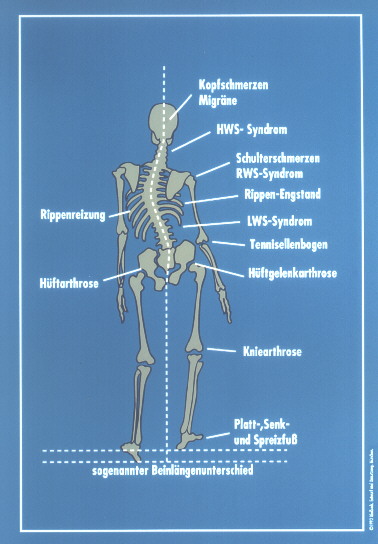 Beckenschiefstand | Rolf Strobel Heilpraktiker